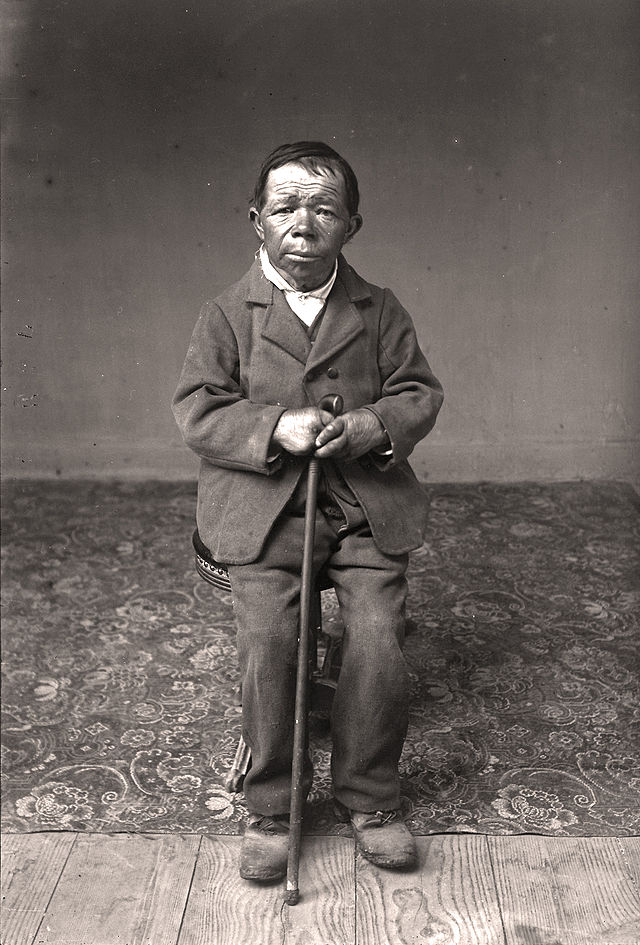 La vraie histoire des cretins des Alpes - Culture générale